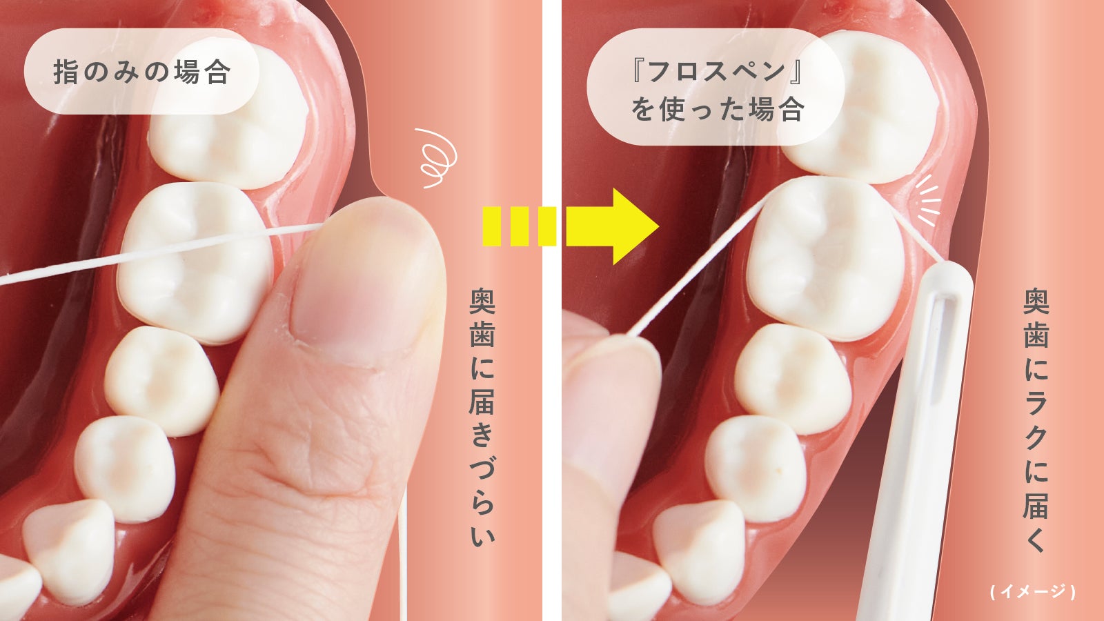 ロールタイプのデンタルフロスの悩みを解決! デンタルフロスサポートツール『フロスペン』の一般販売を開始 ビューティーポスト