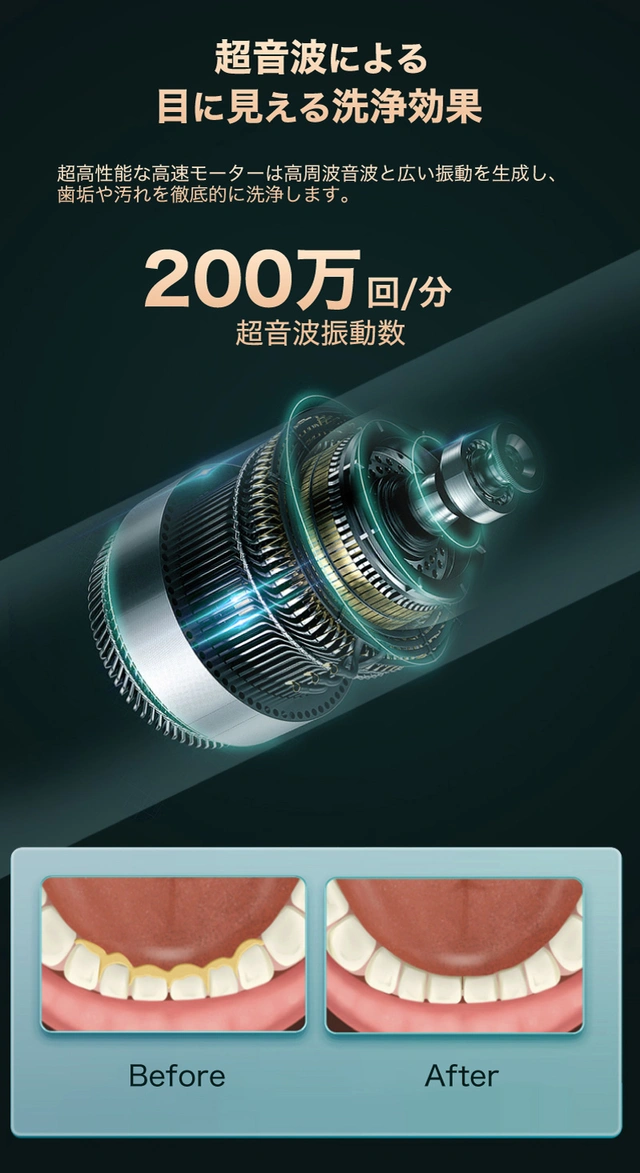 口腔ケアに革命！「ecleaner（イークリーナー）」が応援支援額1,000万円を突破 | 合同会社NEOS Tradingのプレスリリース